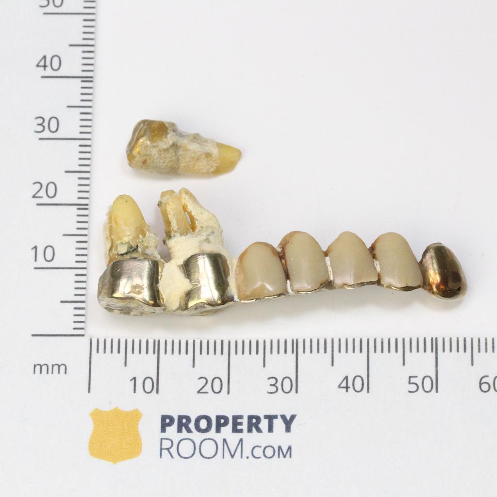 12kt Gold Dental Caps, 13g T.W. | Property Room
