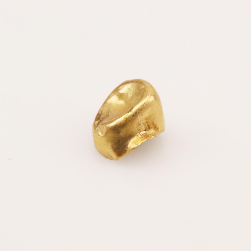 22kt Gold Tooth | Property Room