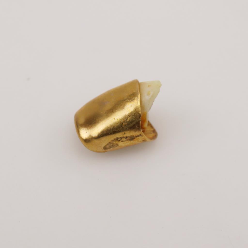 22kt Gold Tooth | Property Room