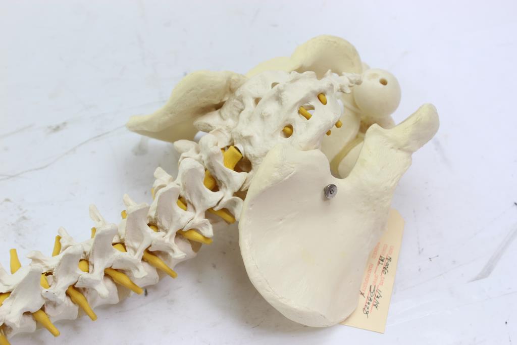 3B Scientific Spine, Pelvic And Occipital Plate Model | Property Room
