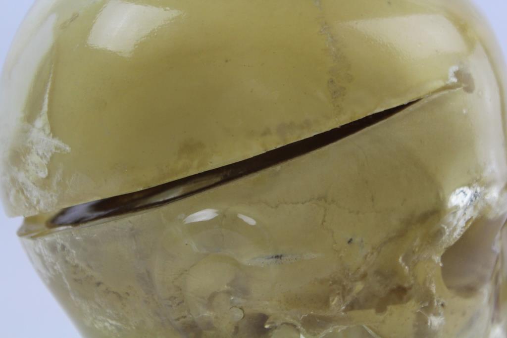 Skull Encased In Head Shaped Material | Property Room